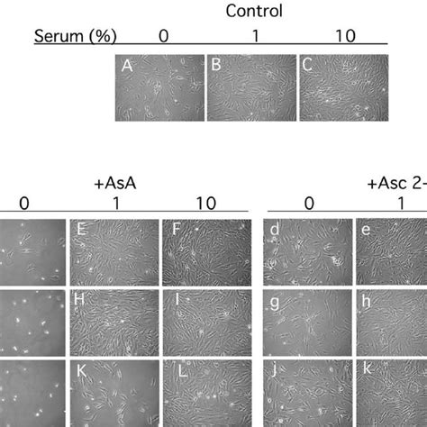 Schematic Representation Of Metabolism Of Ascorbic Acid 2 Phosphate Download Scientific