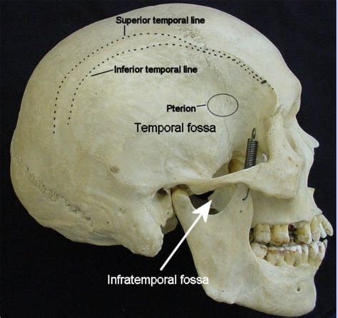Superior Temporal Line