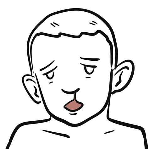 Digeorge Syndrome Armando Hasudungan