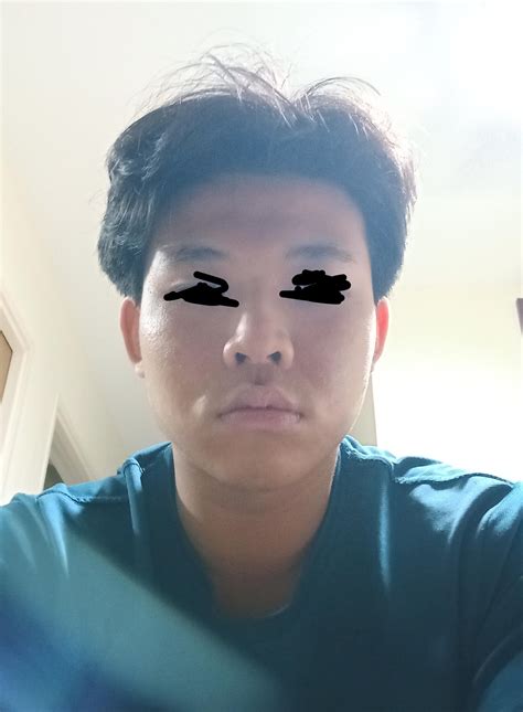 Whats Wrong With My Face And Side Profile Will Mewing Help My Nostrils Are So Big Too Are