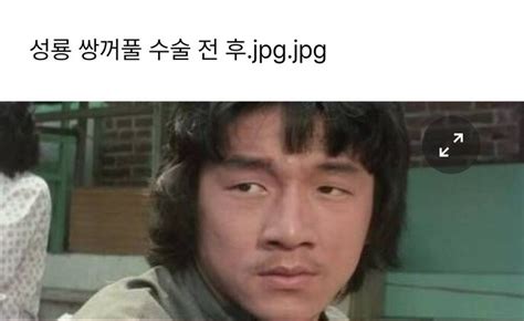 성룡 쌍꺼풀 수술 전 후 성룡 유머 수술