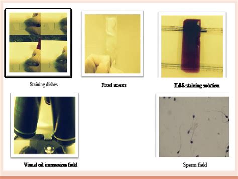 Hematoxylin And Eosin Stain Medical Center Dani Andrology