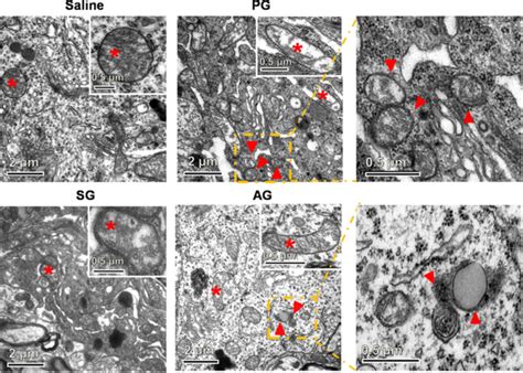 Neuron Electron Microscope Cells Disconnect Synaptic Activity Induces