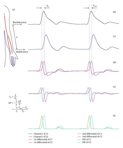 the ptt estimation using simultaneous noninvasive measurements of