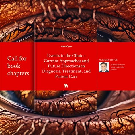 About The Book Dbr42srq “uveitis In The Clinic Current Approaches And