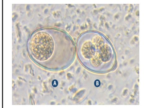 Protozoarios Quizlet