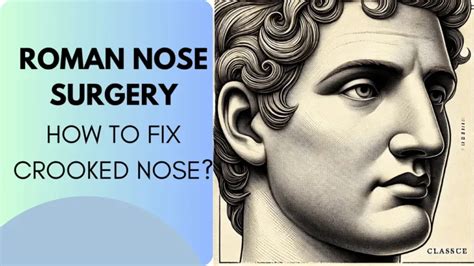 Greek Nose Everything You Need To Know