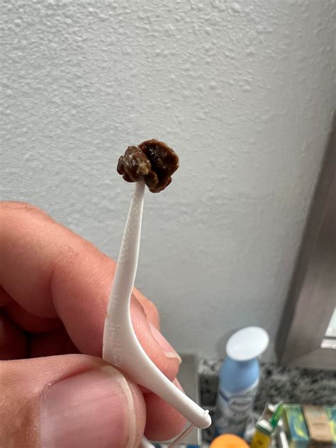 Bought An Earwax Removal Machine This Is My Good Ear Rearwax