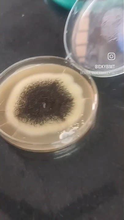 Lactophenol Cotton Blue Staining Aspergillus Fungus Microbiology