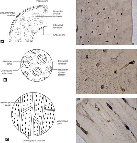 Circumferential Lamellae Histology