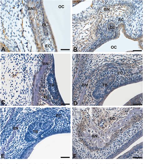 Figure 3 From Role Of Bmp 4 During Tooth Development In A Model With