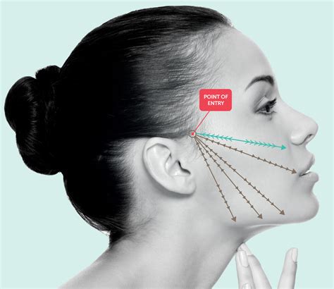 Pdo Threads Highest Quality 1 Rated V Soft Lift International