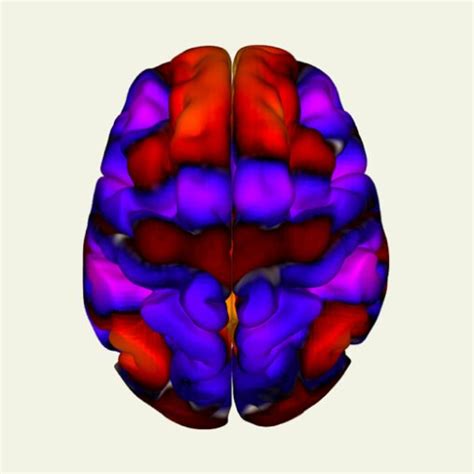 Example Statistical Parametric Map Showing Average Sbc With Download Scientific Diagram
