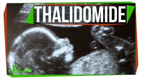 Thalidomide Babies A Resilient Generations Untold Progress Suchscience