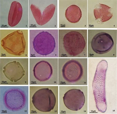 Microphotographs Showing The Morphological Shapes For Pollen Grains Of