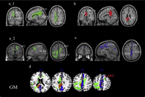 Grey Matter Substrates Of The Imitation Of Transitive And Intransitive