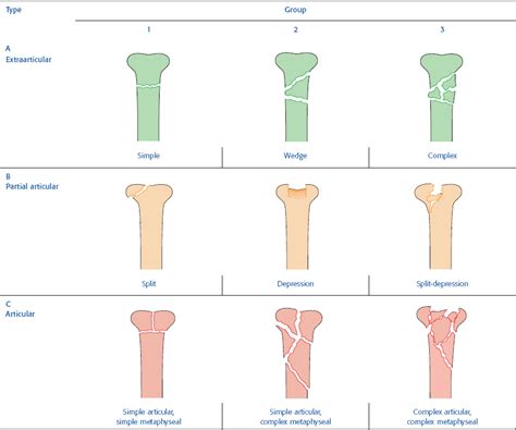 2 2 Fracture Classification Musculoskeletal Key