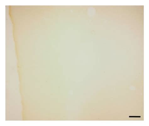 Microphotographs Of The Rat Mpfc Cortex Showing Psa Ncam Immunostaining Download Scientific