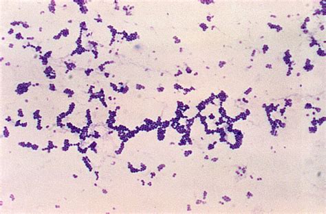 무료 사진 Photomicrograph 구형 Cocci 그램 긍정 포도 상 구 균 균 박테리아 확대 250 X