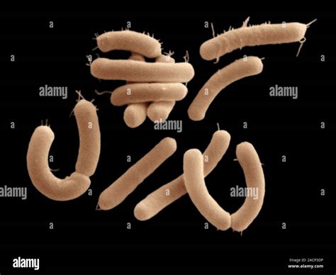 Lactobacillus Rhamnosus Bacteria Coloured Scanning Electron Micrograph