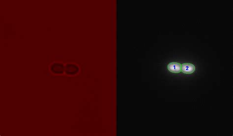 Bioimaging Lab Linear Assignment Tracking Toolbox