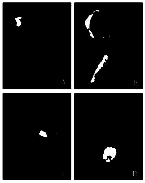 Inducing Method For Murraya Paniculata Callus Eureka Patsnap