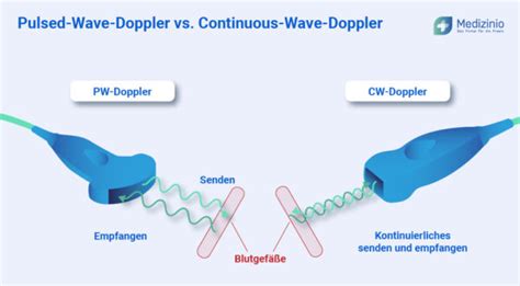 Der Cw Doppler Ultraschall Continuous Wave Doppler