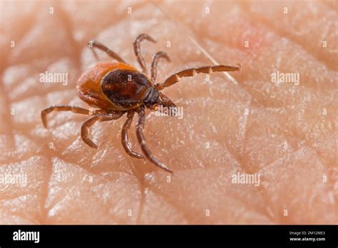 Close Up Of Deer Tick On Human Skin Detail In Background Ixodes