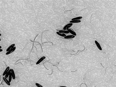 Egg Counting V3 Object Detection Dataset By Matteo