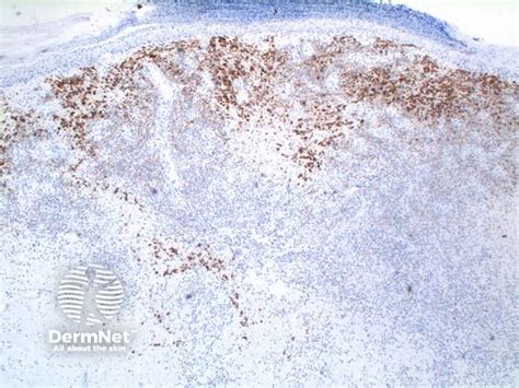 Immunohistochemistry Stains