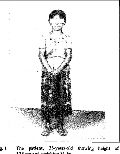 Figure 1 From A Case Of Lingual Thyroid With Hypothyroidism Semantic Scholar