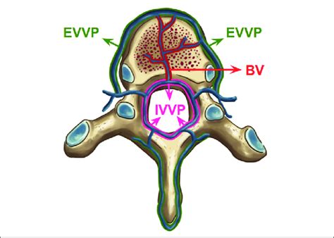 Diagram Illustrating The Vertebral Venous Plexus Highlighting The