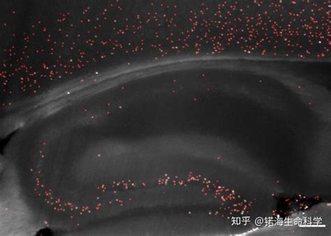 组织透明化三维成像技术揭示小鼠整脑c Fos蛋白分布 知乎
