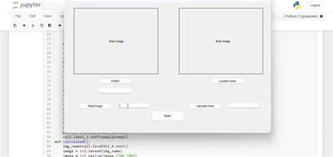 My Project Brain Tumor Detection With Pyqt5 Hasan Abdulrahman