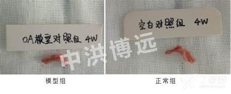 【讨论】 药物诱导小鼠骨关节炎 知乎