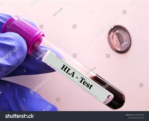 Hla Lab Stock Photos Images Photography Shutterstock