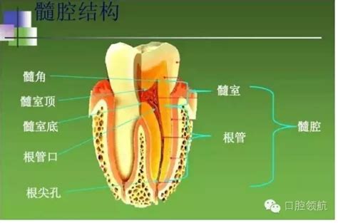 开髓术 牙体牙髓 陕西嘉友科贸有限公司