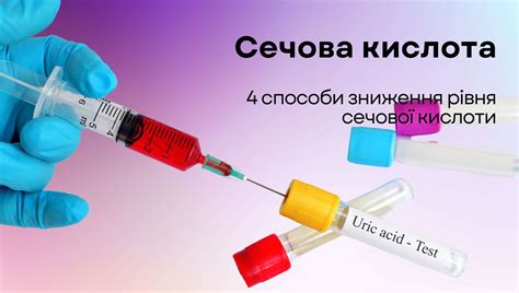 Що робити якщо в крові підвищена сечова кислота Нефроцентр