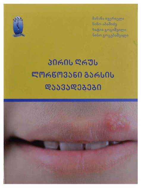 ლორწოვანი ივერიელი Pdf