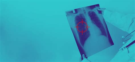 A New Artificial Intelligence Diagnostic Tool Can Detect Diseases On Chest X Rays Directly From