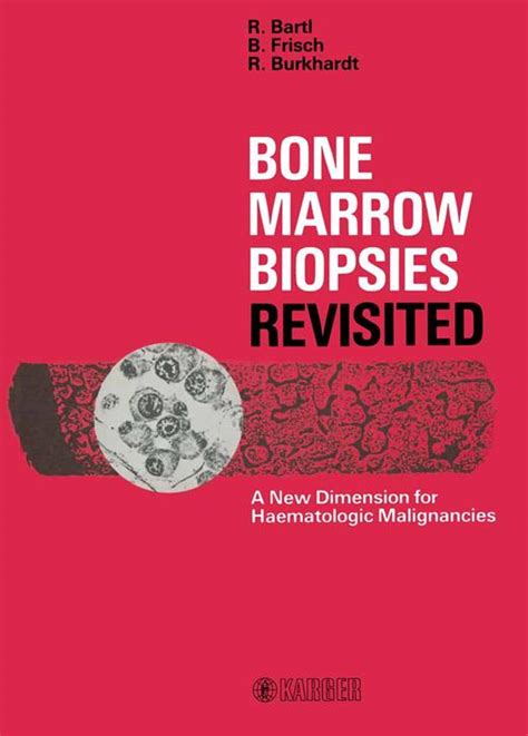 Bone Marrow Biopsies Revisited A New Dimension For Hematologic Malignancies Books Gateway