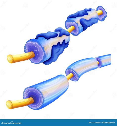 Myelin Deterioration Stock Illustration Image Of Diagram