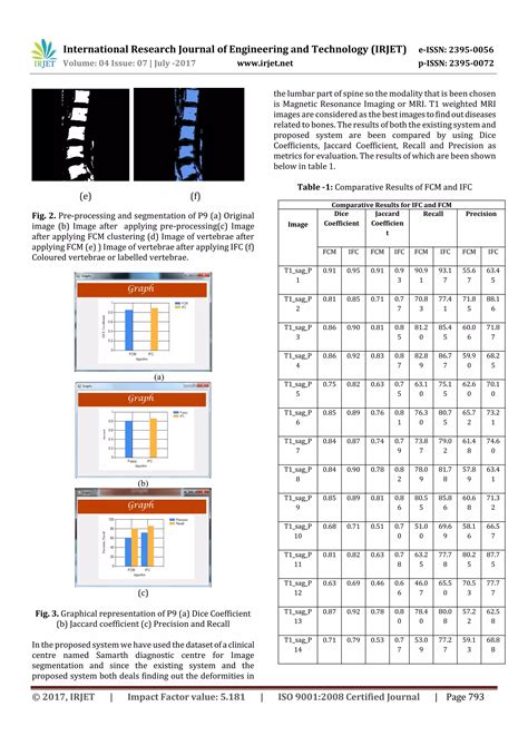 Intuitionistic Fuzzy Clustering Based Segmentation Of Spine Mr Images Pdf