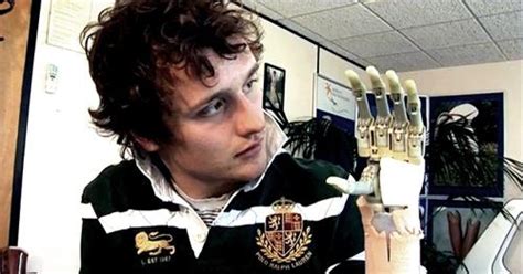 인공 눈·팔로봇인간시대의 도래