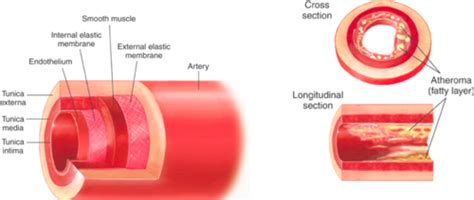Peripheral Vascular System Flashcards Quizlet