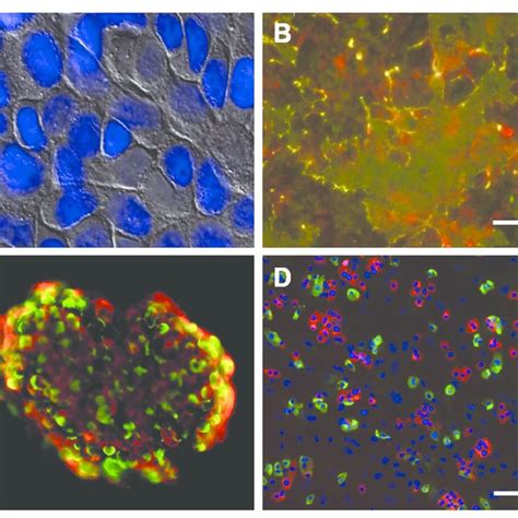 Preparation Of Surface For Islet Cell Culture System A Human Bladder
