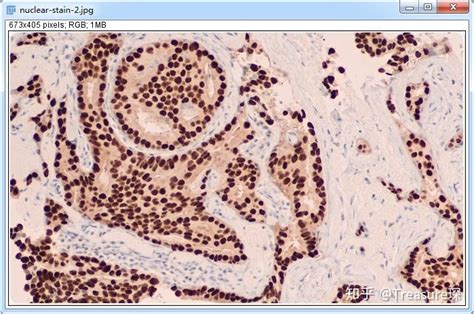 Imagej实用技巧——免疫组化分析 定量分析篇 知乎