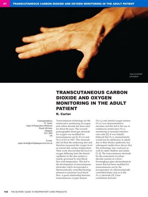 Transcutaneous Carbon Dioxide And Oxygen Monitoring In The Adult