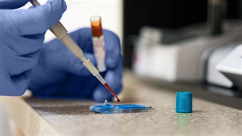 What Are RBC Indices And Why Might A Person Need Them