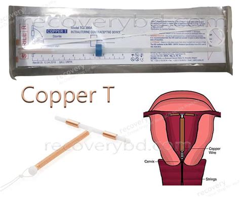 Copper T Iud Contraceptive Device